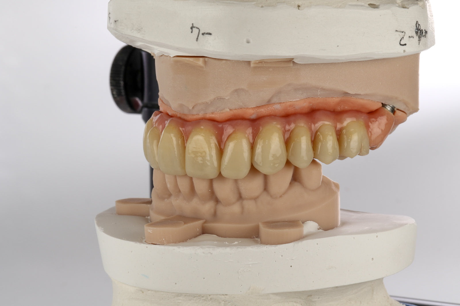 Klinischer Fall | Dr. Amir Badali Haqi – SAREMCO Dental AG