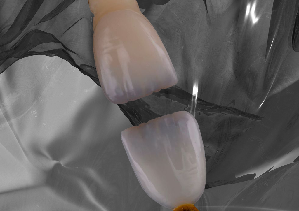 saremco print CROWNTEC – 3D-Printed Dental Restorations with CE ...